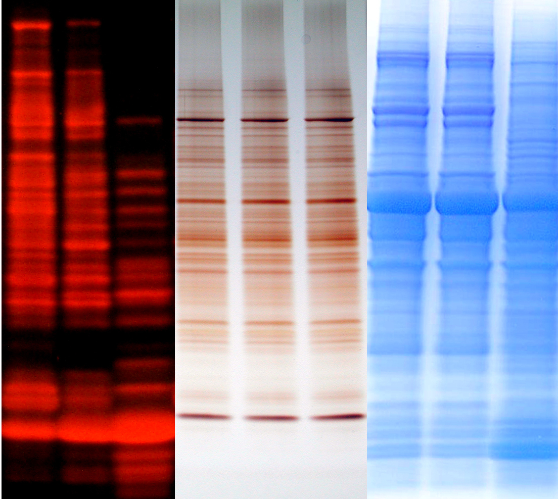 Which Stain is Most Compatible with Mass Spectrometry?