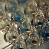 Protein Estimation Methods