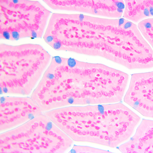 Key Differences of H&E and Special Stains for Immunohistochemistry