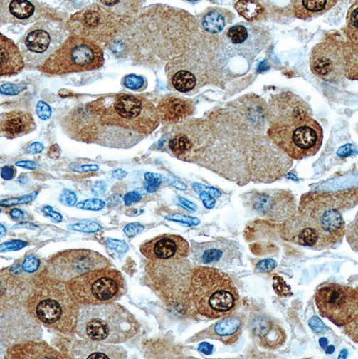 Specificity of Immunostaining methods: How to choose a control?