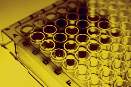 The Sandwich ELISA: Process and Practical Applications