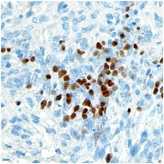 An Overview of Histology Fixatives